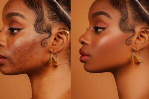 How to Retouch Photos in Photoshop – Professional Step-by-Step Guide